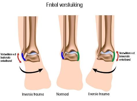 Enkel Archives - HC Health